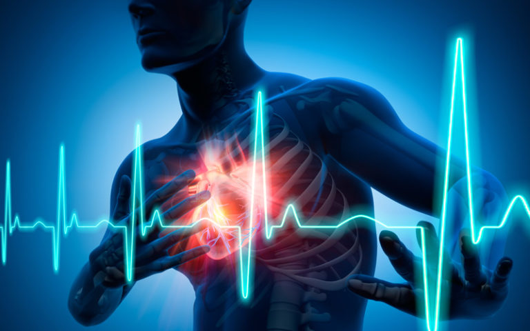 Que savez-vous de la crise cardiaque ? - Cardiosecours - Blog